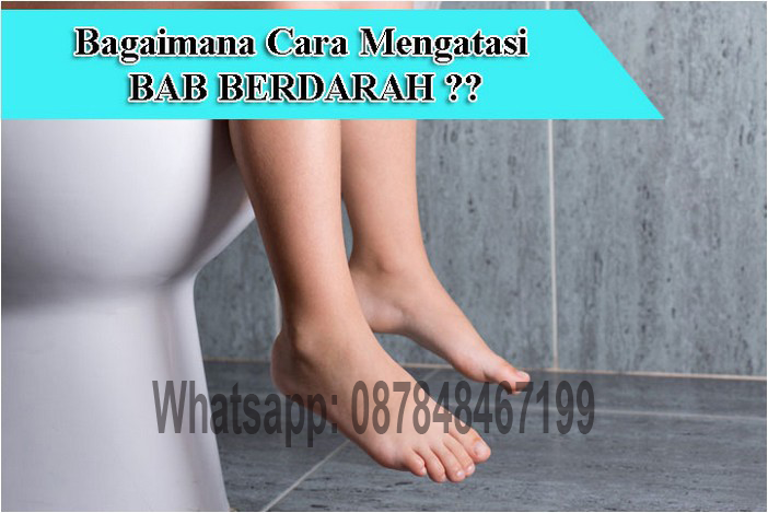 Daftar Obat Antibiotik Untuk Bab Berdarah Saran Dokter Spesialis ...