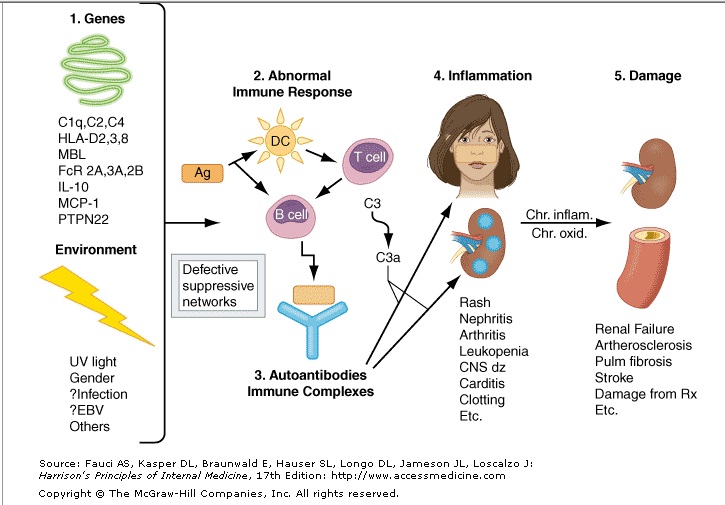 Intan Risna's: Systemic Lupus Erythematosus (1)