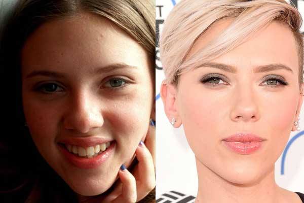 13 famosos que se operaron la nariz y dejaron de ser feos - Foros Perú