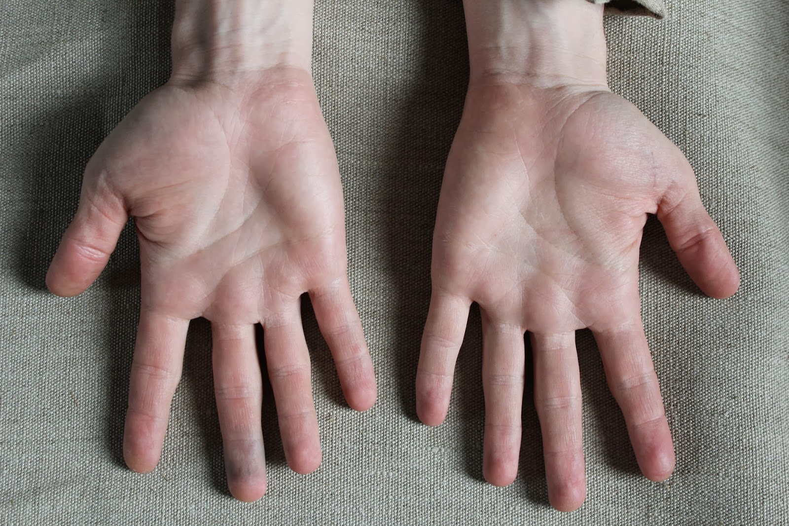 Ran Away From The Subscriber: Hands of Tentmakers