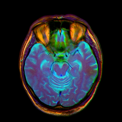 Nevit's blog: Color MRI of the Brain