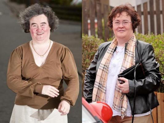 Susan Boyle After Plastic Surgery She Also Told The Public If She Was ...