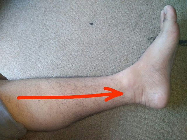 3 POINT URUTAN SAKIT TAPAK KAKI & IBU JARI KAKI