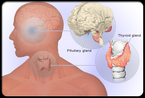 To Reduce HyperThyroid Problem ~ The Official Blog of Grannytherapy