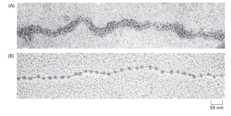 Genetics Nucleosomes Basic Unit Of Eukaryotic Chromosome