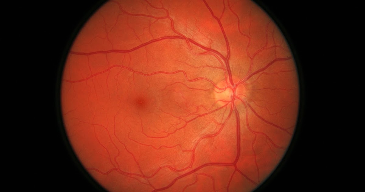 La Mitocondria: Nuestros tejidos VI: Tejidos epiteliales (epitelio ...