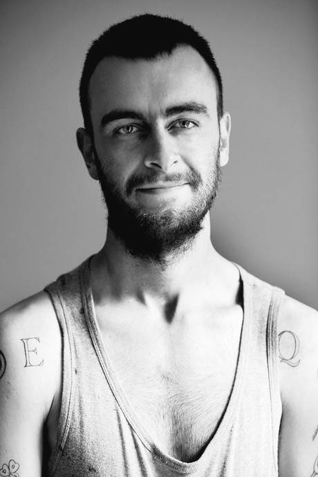 Joe Gilgun Teeth