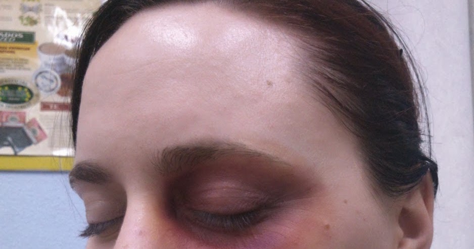 Makeup Laura pCh: || SPECIAL EFFECTS || Hematoma en el ojo ☠