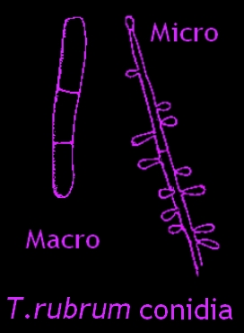 Fun With Microbiology (What's Buggin' You?): Trichophyton rubrum
