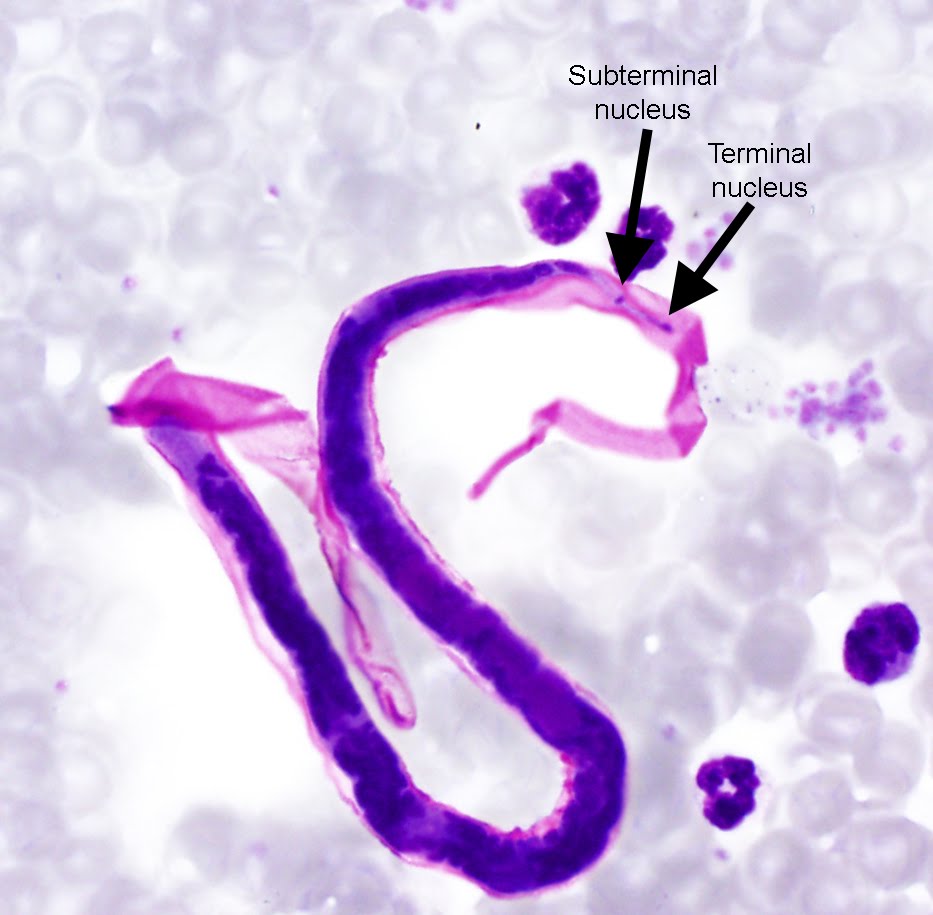 Medical Chemical Corporation: Para-site