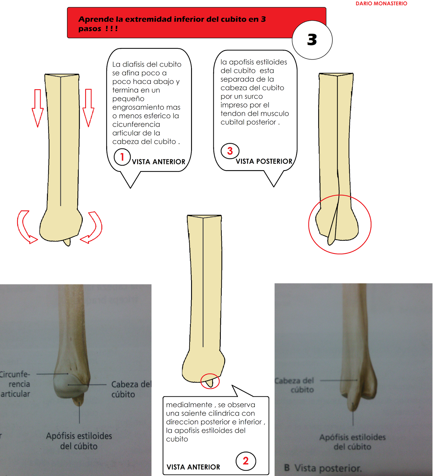 ANATÒMICO VIRTUAL : "CUBITO & RADIO": OSTEOLOGIA (EL RADIO)