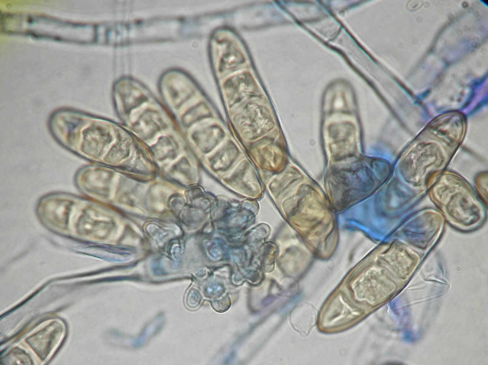 ATLAS MICOLOGIA: DRECHSLERA