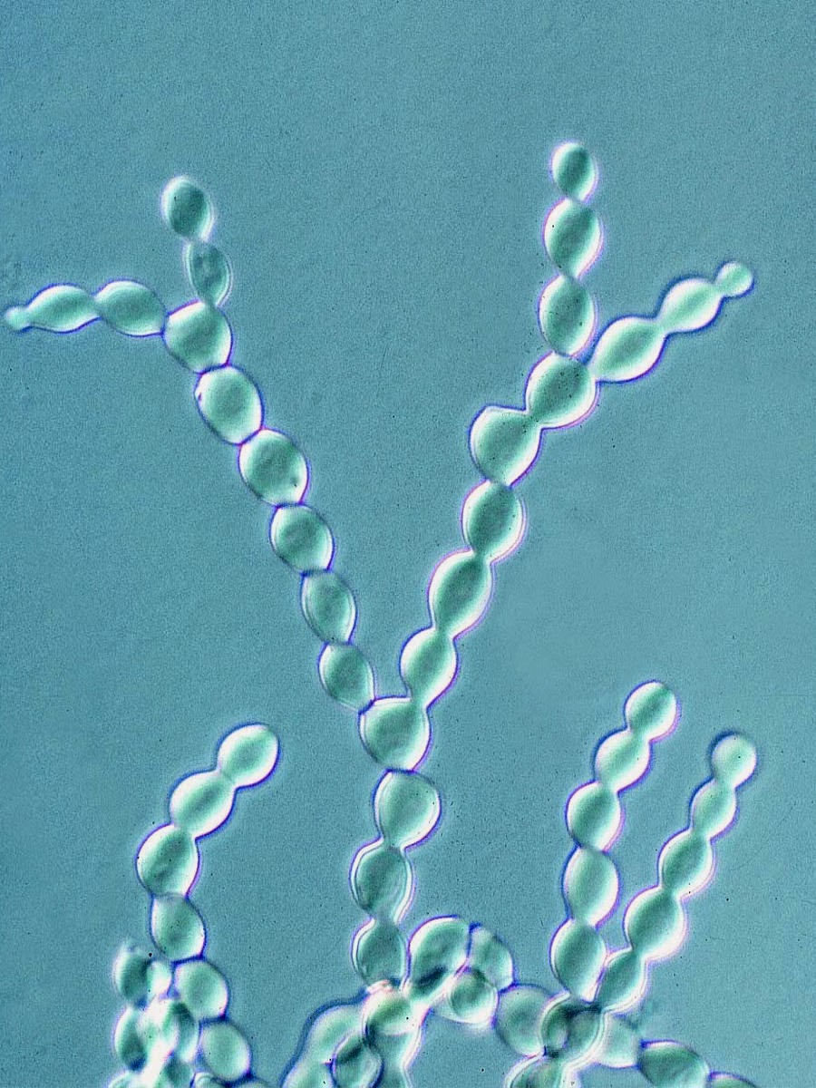 Ciencias de Joseleg: Formación de los conidios, parte 1