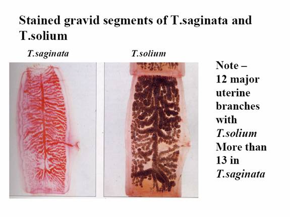Medical Laboratory Technology - SOP: Taenia Saginata/ Taenia Solium