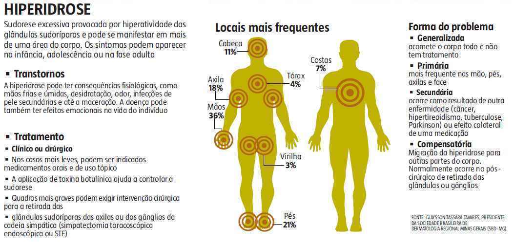 Fluoxetina Virtual: O que é Hiperidrose, tratamento, cirurgia, tem cura