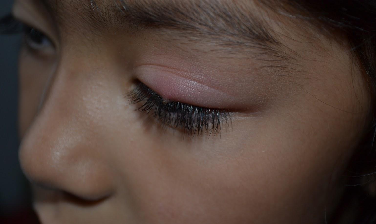 Diseases Of The Ear Nose And Throat - eazyfile