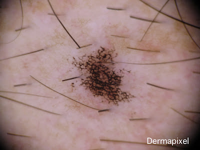 Dermapixel: mayo 2019