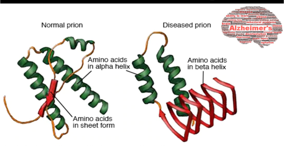 Definition Prions and Protein misfolding Diseases: Alzheimer’s disease ...