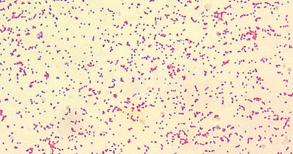 Brucella abortus (Brucellosis) - Microbiology Laboratory Turkey