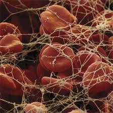 Susan Salvo: The Massage Passionista: Massage Therapy and BLOOD CLOTS