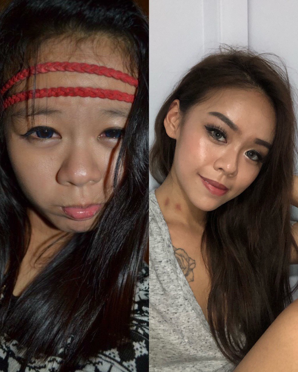 Nose Threads Or Nose Fillers?