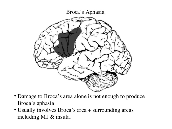 ΝΕΥΡΟΑΝΑΤΟΜΙΚΗ ΒΑΣΗ ΤΗΣ ΑΦΑΣΙΑΣ ΤΟΥ Broca | Γραφωνήματα - Love My ...