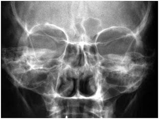 radiologia de cara y cuello