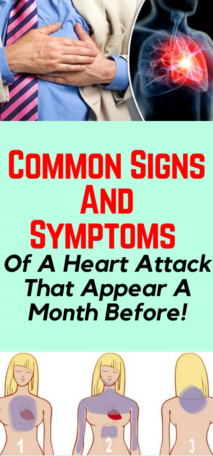 Daily Health Advisor : Common Signs And Symptoms Of A Heart Attack That ...