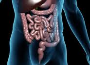 Ulcerative colitis - complications megacolon and intestinal perforation