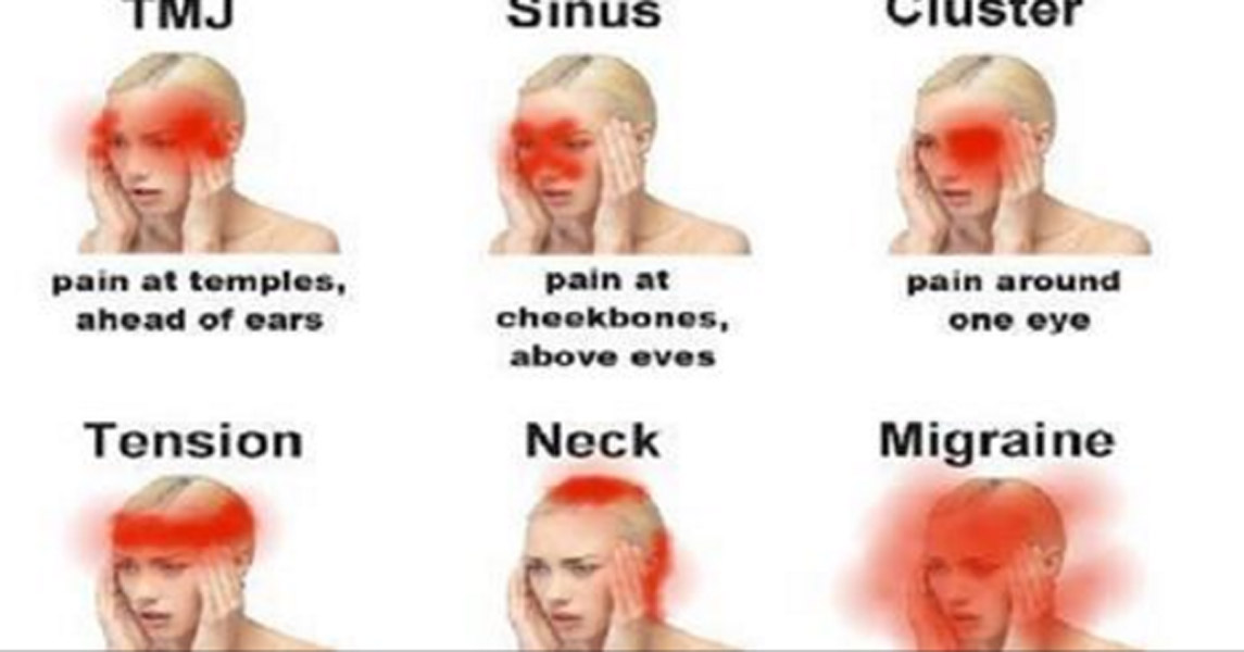 How to Recognize Which Headache is Dangerous - The Discover Reality