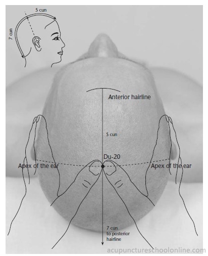 Syifa' Penawarku: Akupuntur Point Du20 (Baihui)