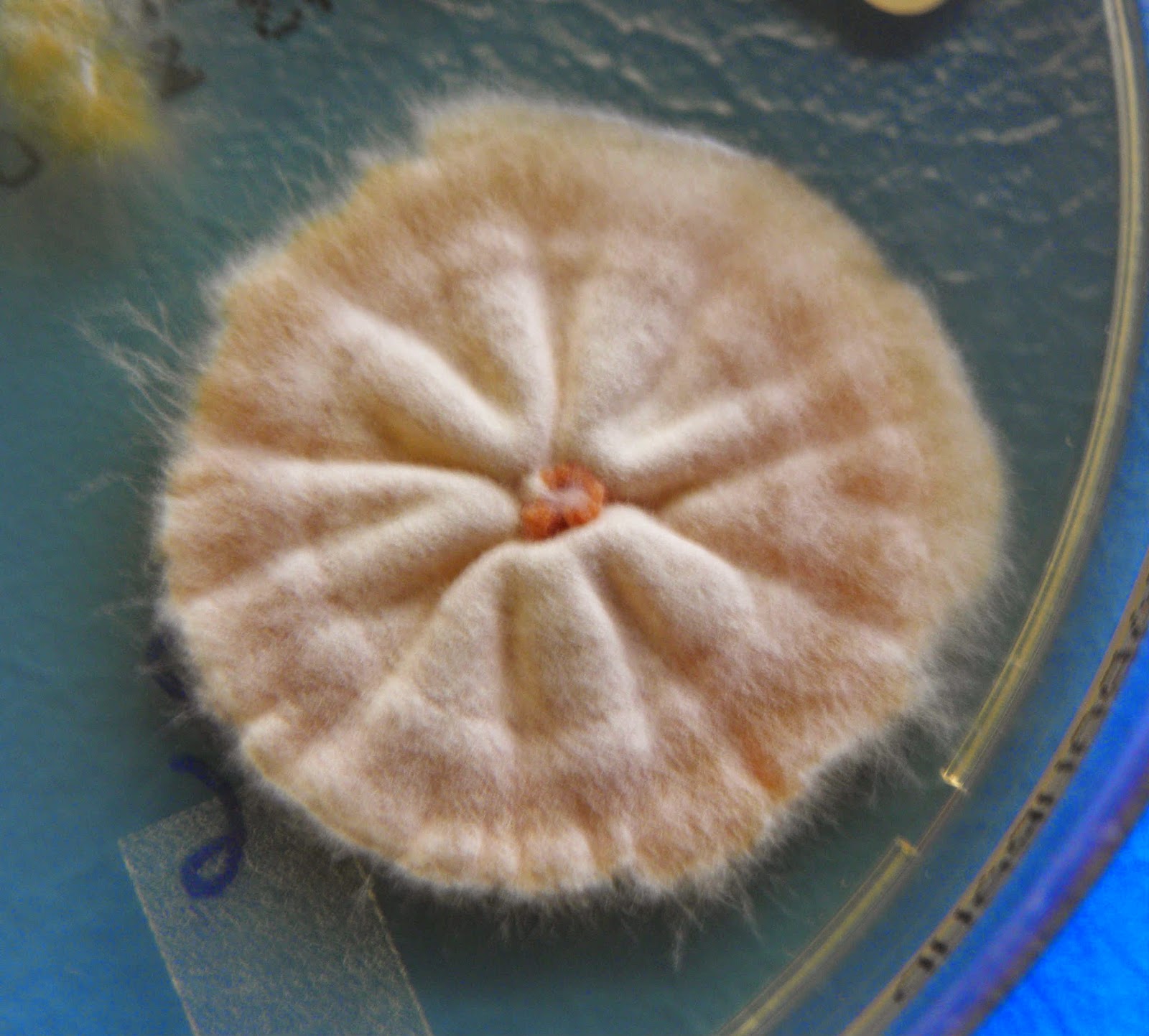 ATLAS MICOLOGIA: TRICHOPHYTON TONSURANS (2)