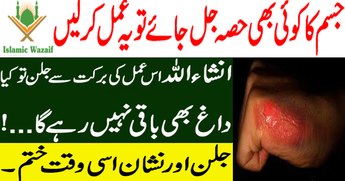 Wazifa For Burn Skin/Jalay Jisam Kay Lia Khas Wazifa/Beauty Tips In ...