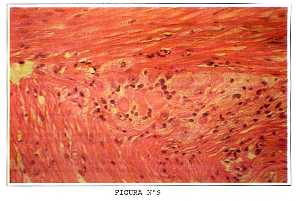 Aparato Digestivo: Aparato Digestivo