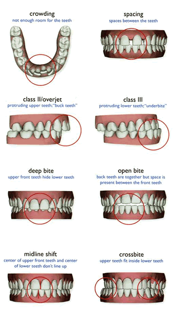 THE DENTAL ENCYCLOPEDIA: INVISALIGN