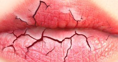 GET RID OF DRY LIPS, DEAD SKIN OR PUFFY EYES… | HEALTHYLIFE