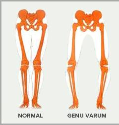 PERSONAL TRAINER H. UMMAN EMEKSİZ: POSTÜR (DURUŞ): POSTÜR NEDİR, DURUŞ ...