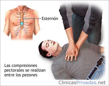 Enfermería Quirúrgica: Paro Cardiaco