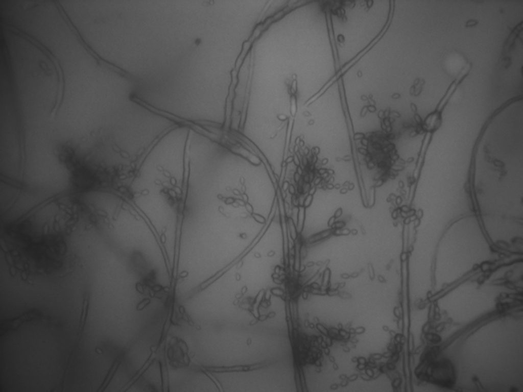 plant pathology 631 lab report: Lab 1 visulization of different fungul ...