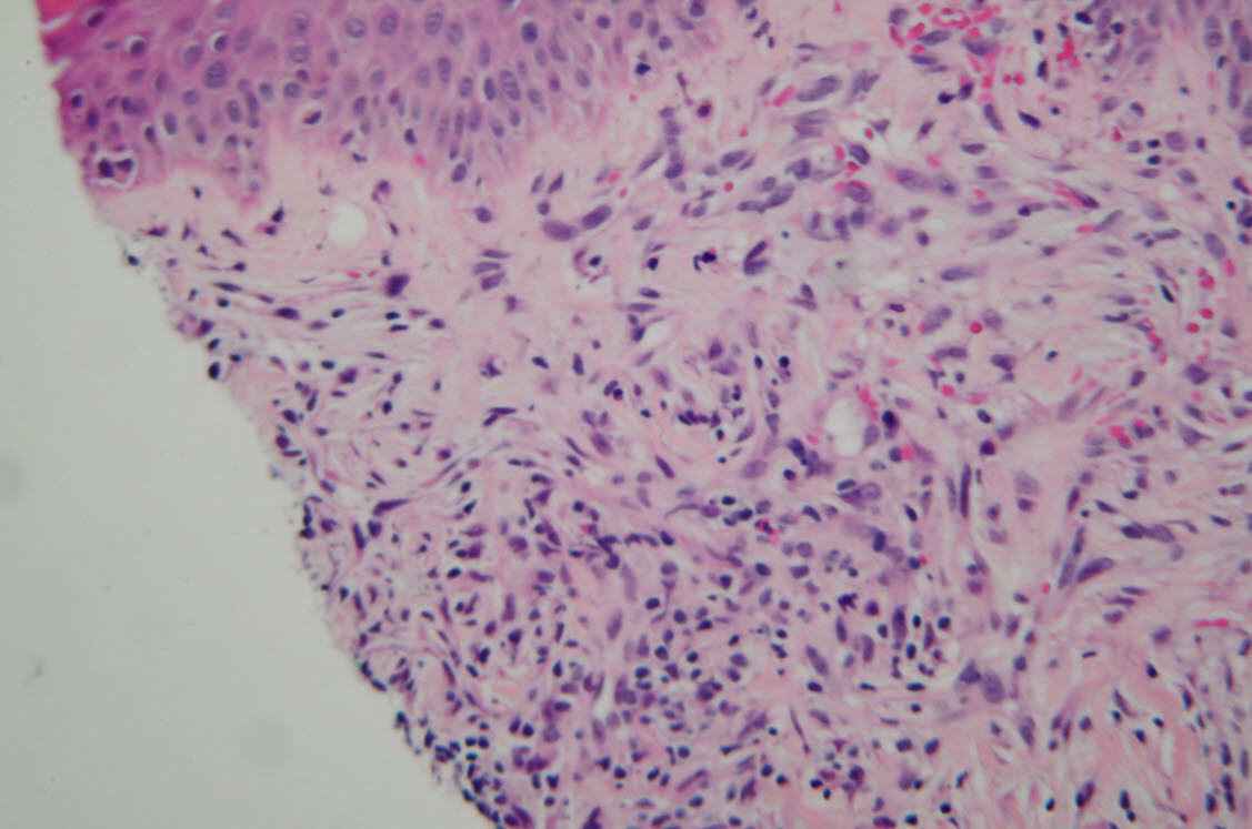 Consultations in Dermatoscopy: Pink and Purple