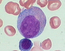 Blog Juruteknologi Makmal Perubatan @ MAD LAB BLOG: White Cell Basics ...