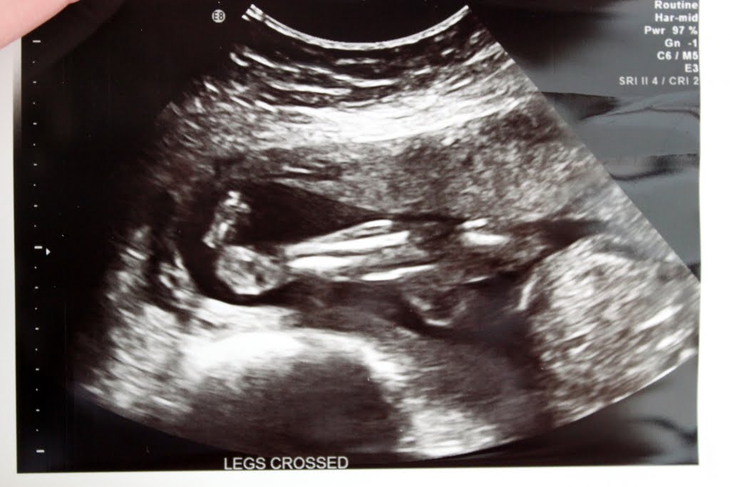 Fowle Family Adventures: 21 Weeks and Ultrasound!