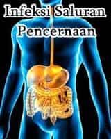 Obat Infeksi Saluran Pencernaan