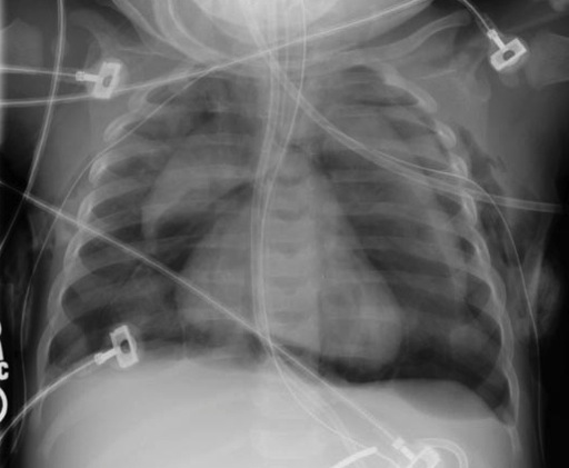 Imagining Imaging: SILHOUETTE SIGN