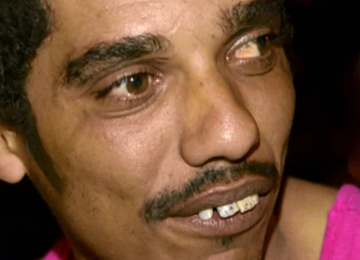 Fotos Do Homem Mais Feio Do Mundo