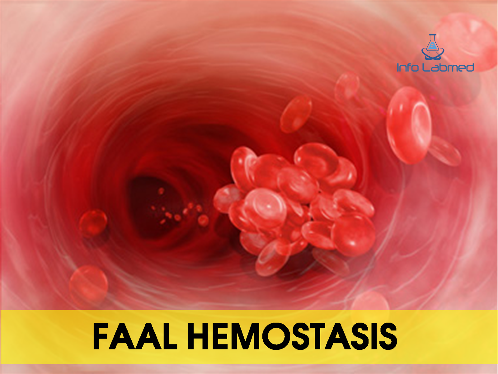 Faal Hemostasis | Seri Edukasi Ahli Teknologi Laboratorium Medik