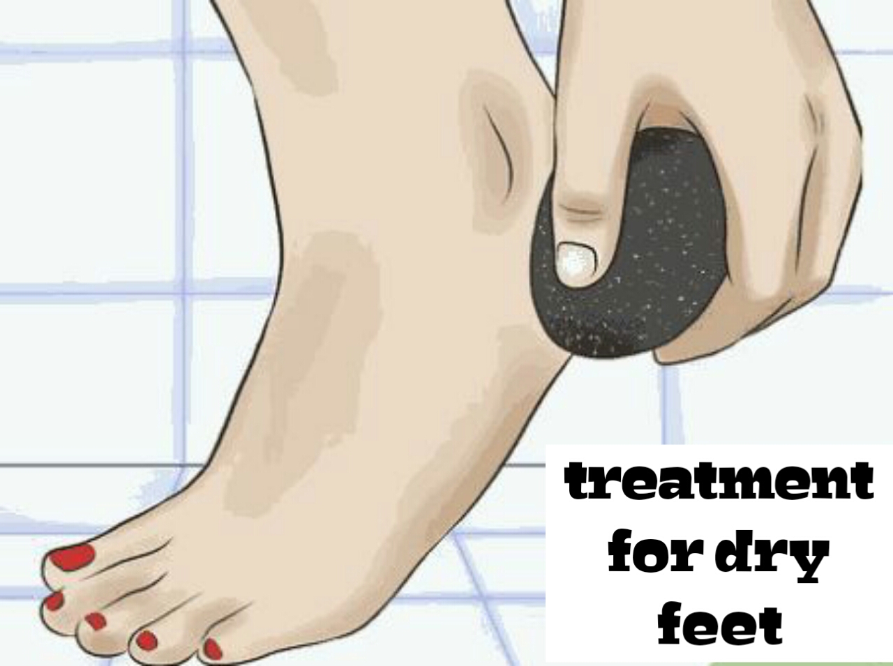 health and beauty tips: Treatment for dry feet
