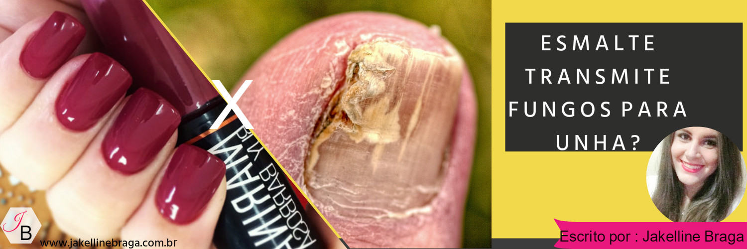 Blog de Podologia,Saúde e Etc.: Podologia: Esmalte transmite fungos nas ...