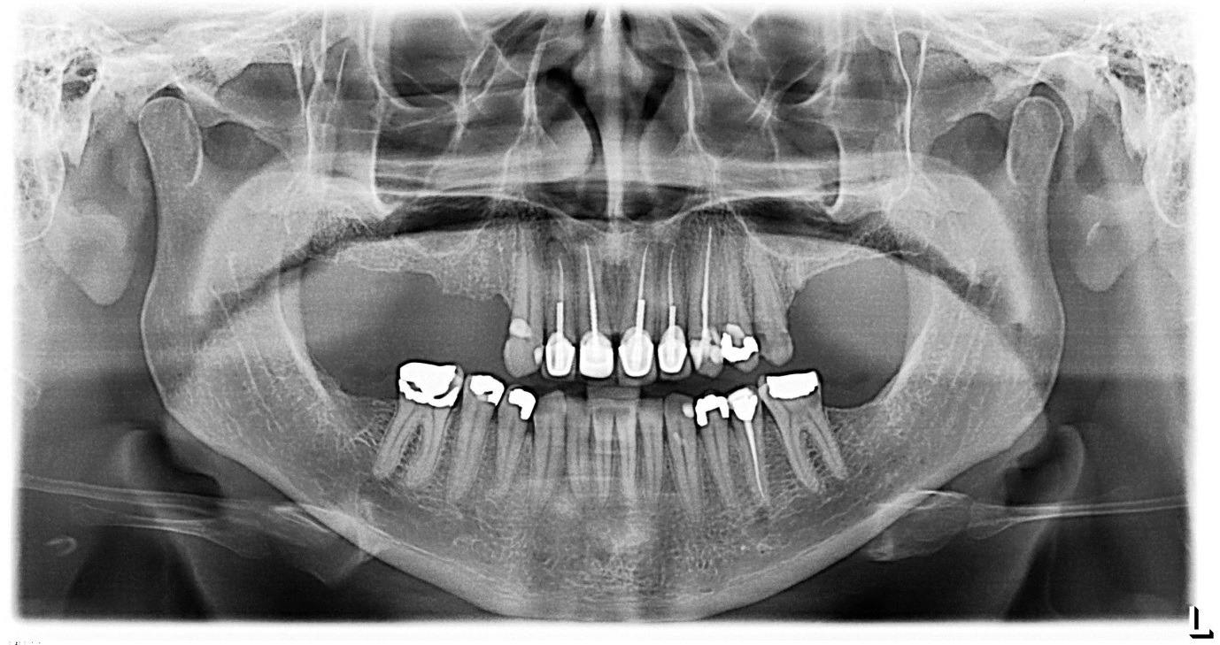 Zobozdravstvo: marec 2018