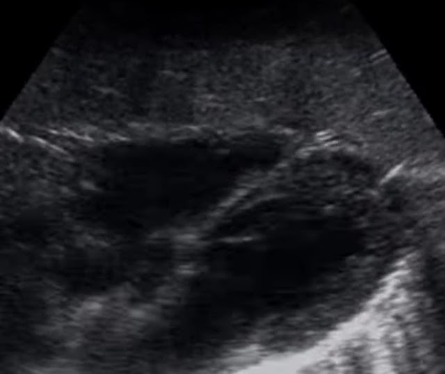 EMS SOLUTIONS INTERNATIONAL by @DrRamonReyesMD marca registrada ...